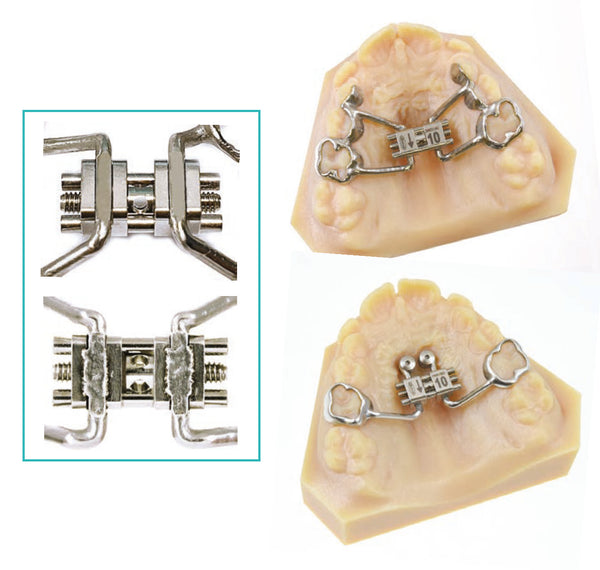 CAD/CAM Anatomical Expander – DB Lab Supplies